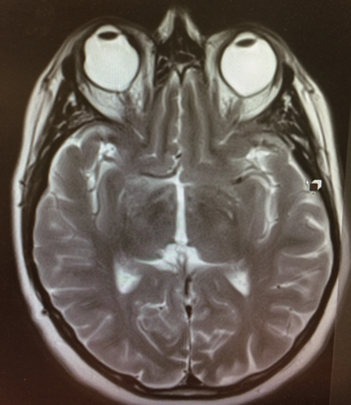 On the wrong track | Eye News