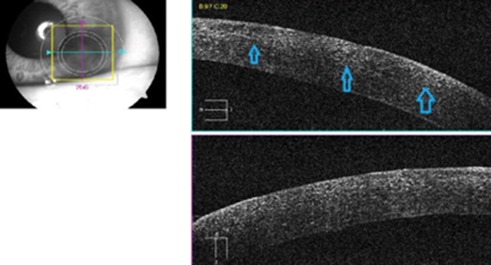 A step-by-step approach to the diagnosis and management of Sands of ...