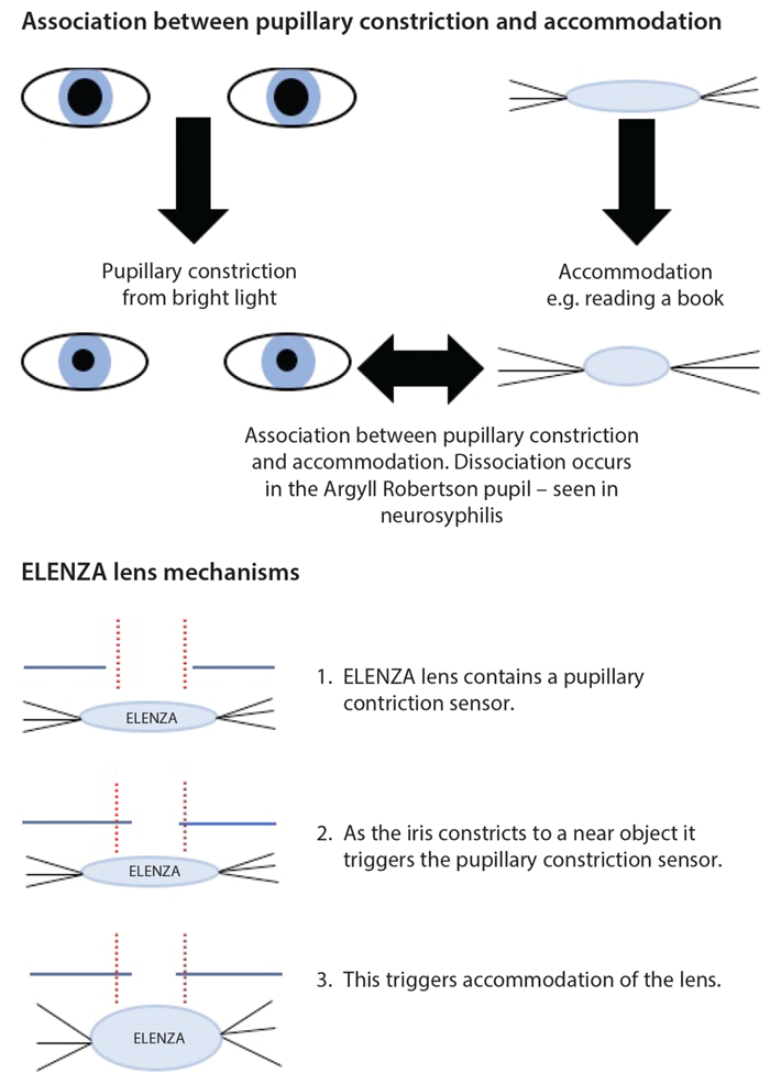 Muscle Light Ophthalmology | Americanwarmoms.org