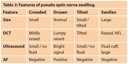 Optic nerve swelling – your survival guide (part 1) | Eye News