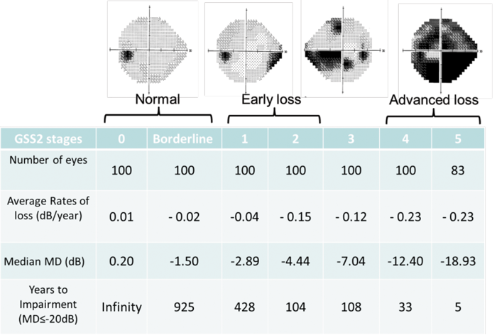 The structure function relationship in glaucoma | Eye News