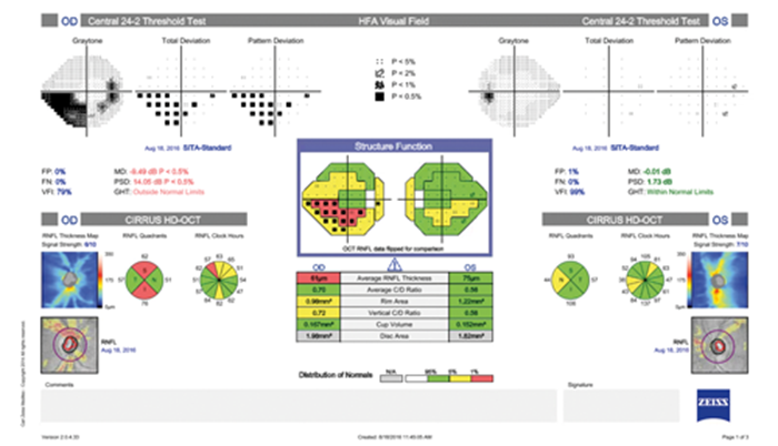 Zeiss Forum | Eye News