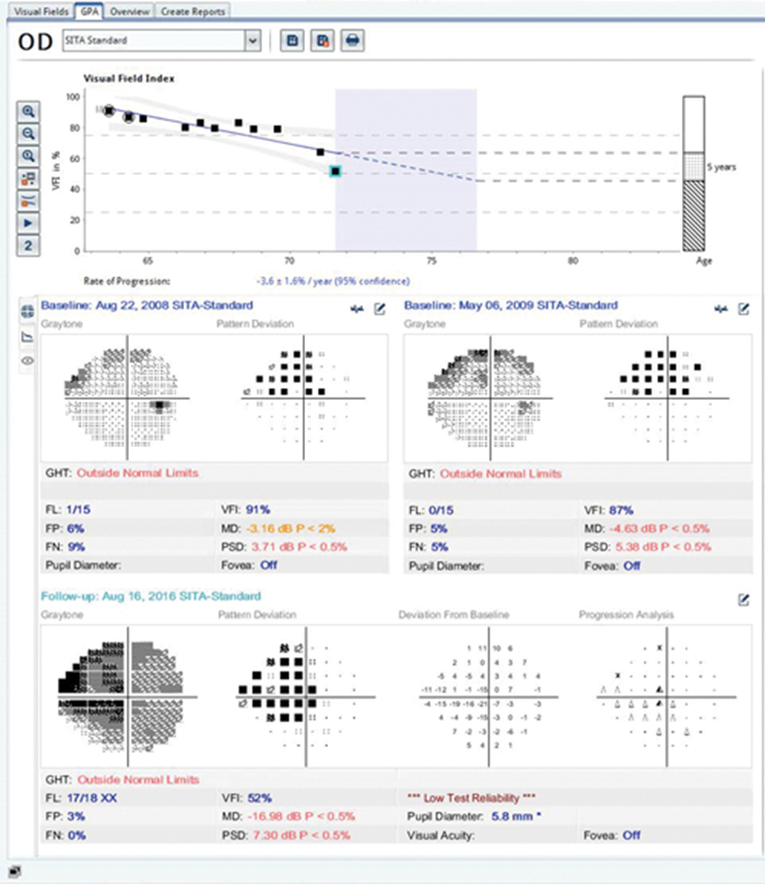 Zeiss Forum | Eye News