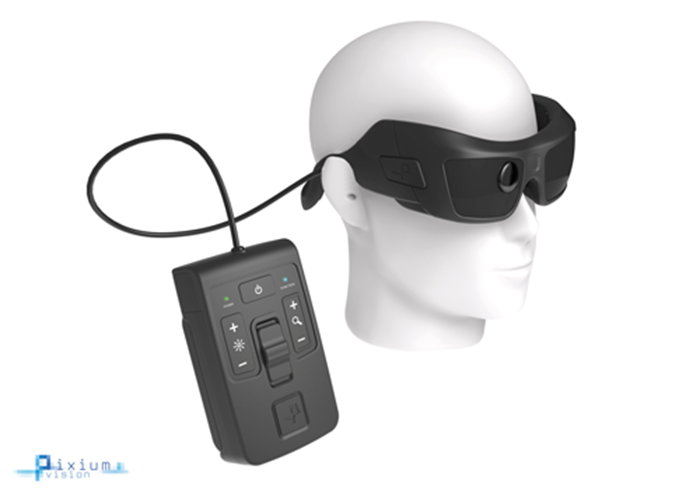 The bionic eye – behind the headlines | Eye News