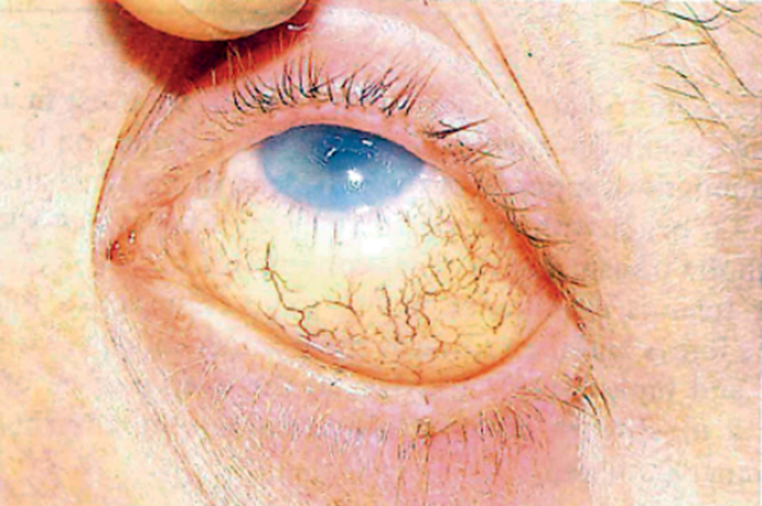 Principles of management | Eye News