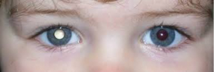 Embryology in clinical practice | Eye News