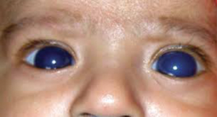 Embryology in clinical practice | Eye News